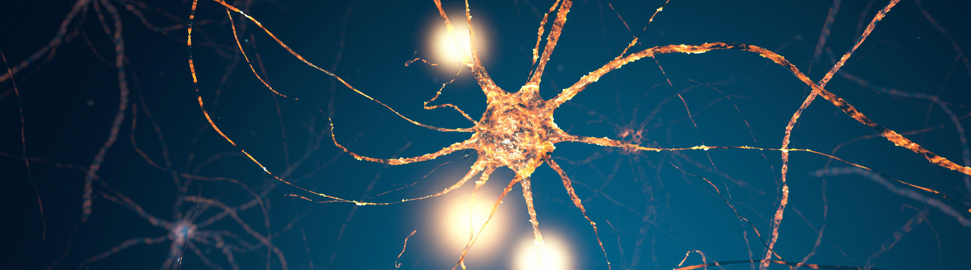 Comprehensive Neuroscience Center | UAB