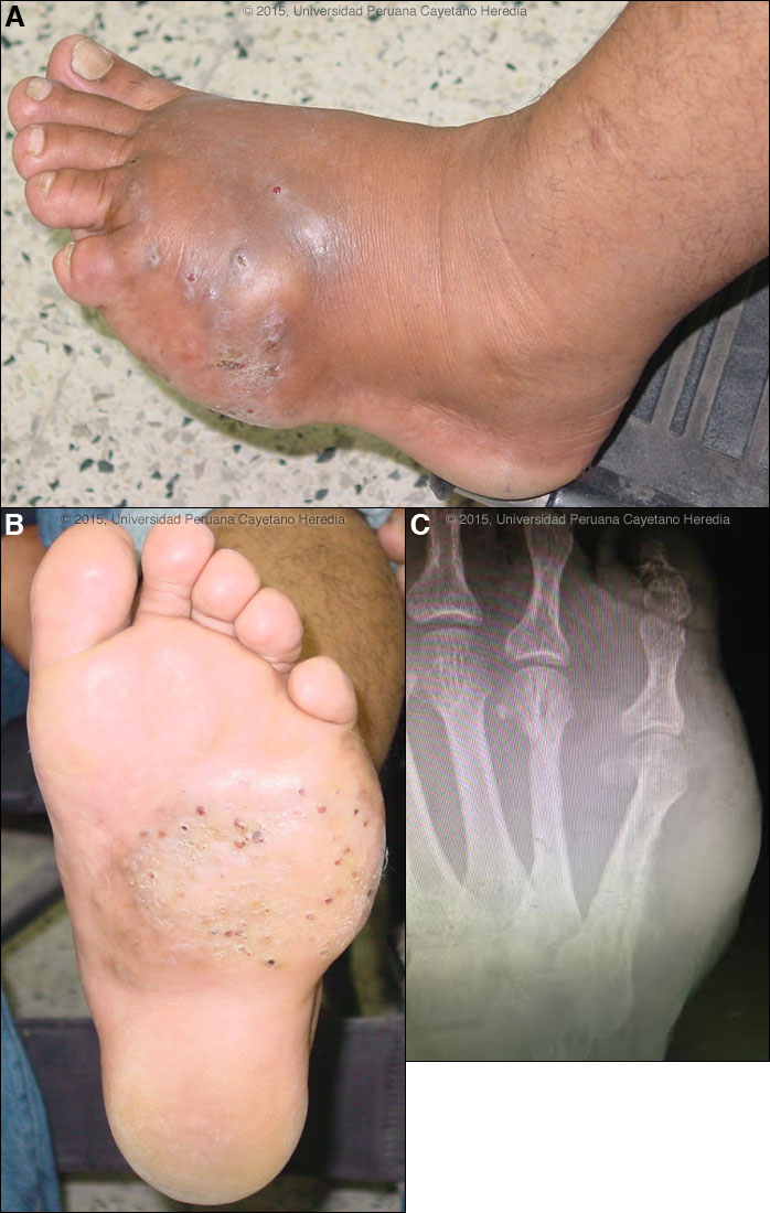 Case 2015-08 - Gorgas Course