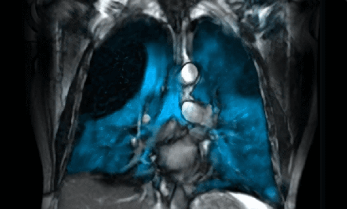 CLAIR and Research MRI Core launch groundbreaking Xenon-129 lung ...