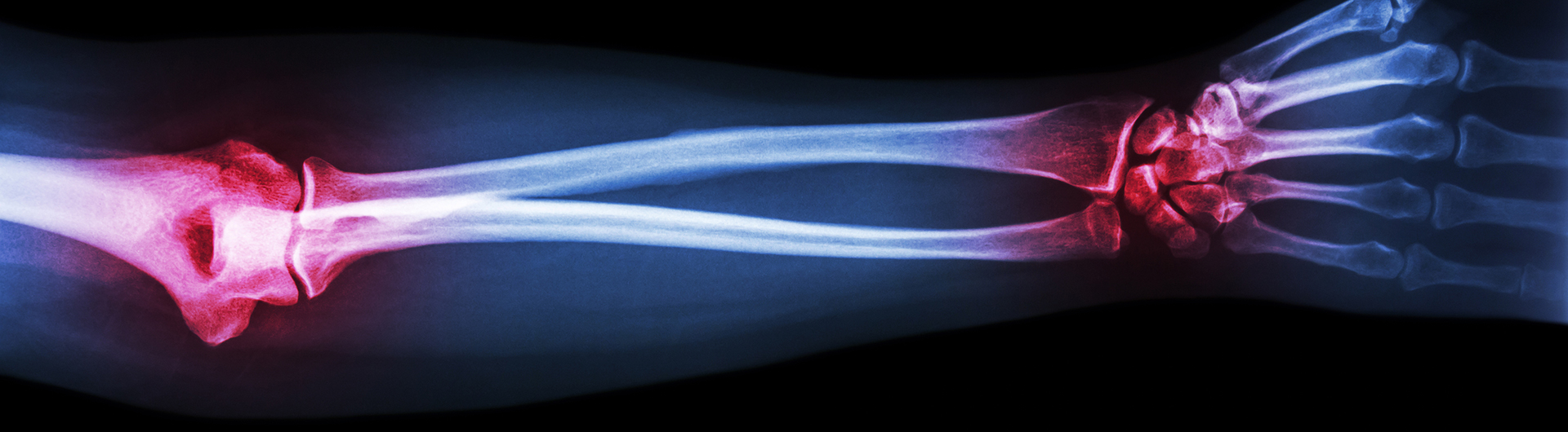 Clinical Immunology and Rheumatology | UAB